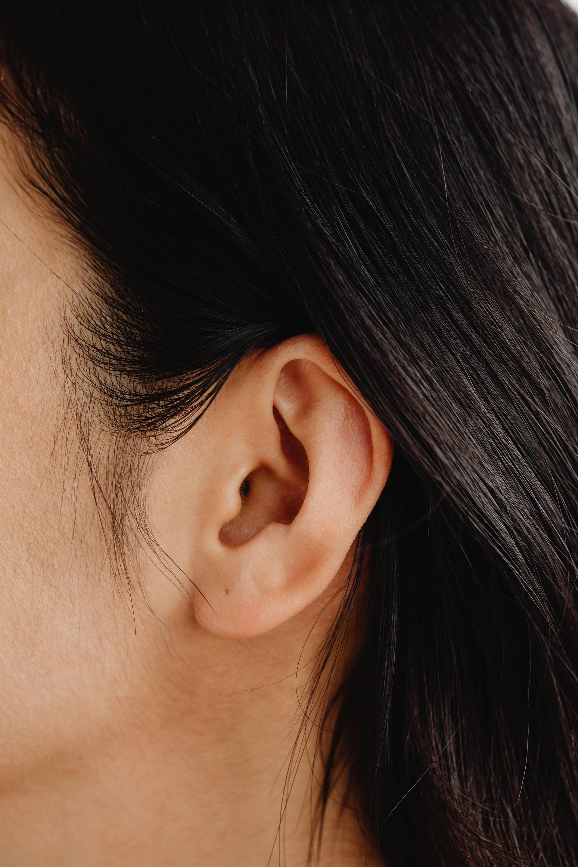 Here's Why Some People Have This Tiny Hole Above Their Ear - Opposing Views