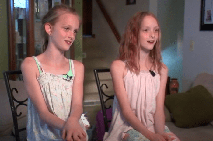 Over A Decade Ago Conjoined Twins Were Separated Through Surgery, Now ...