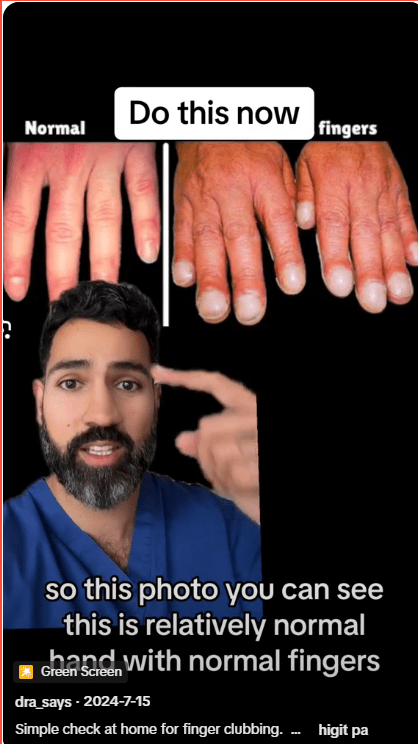 This Simple Test Can Help Detect If You Have Cancer - Opposing Views