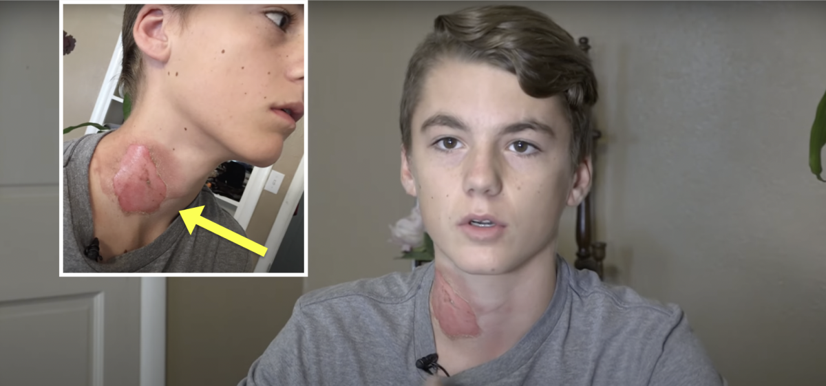 Boy Wakes Up In Severe Pain During Sleepover With Friends, Notices ...