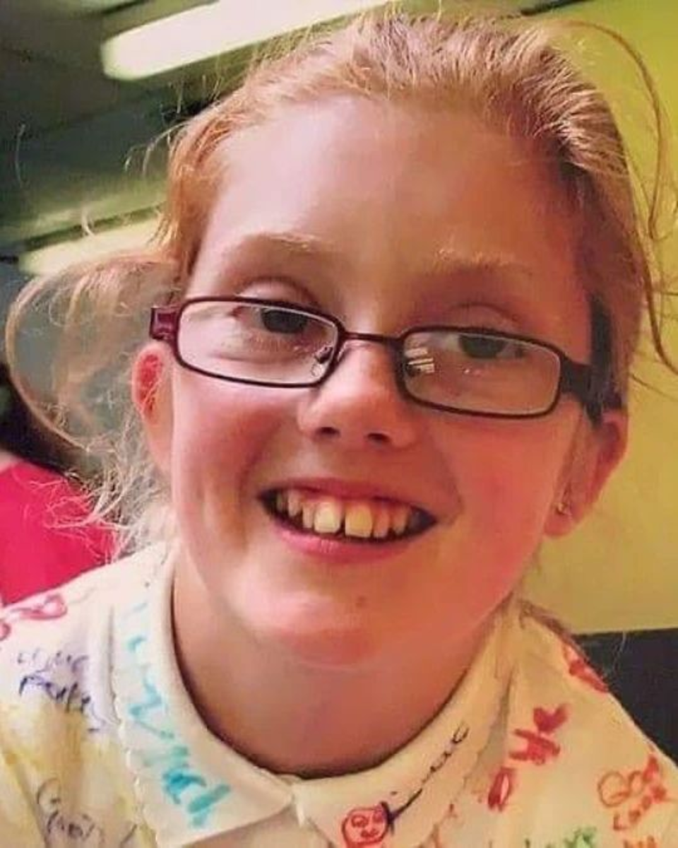 Young Girl Was Bullied For Her Red Hair How She Looks Now Will Make You Do A Doubletake