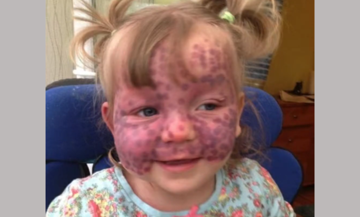 Little Girl Born Covered In 'Polka Dots', Then Doctors Discover The ...